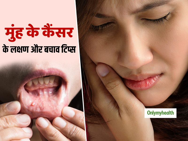Oral Cancer 45 की उम्र के बाद बढ़ जाता है मुंह के कैंसर का खतरा जानें